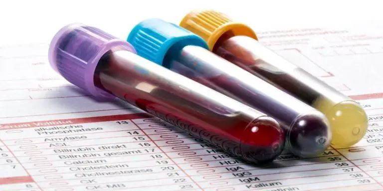 Emocromo: Alto, Basso, Valori e Alterazioni in caso di Tumore - Non ...